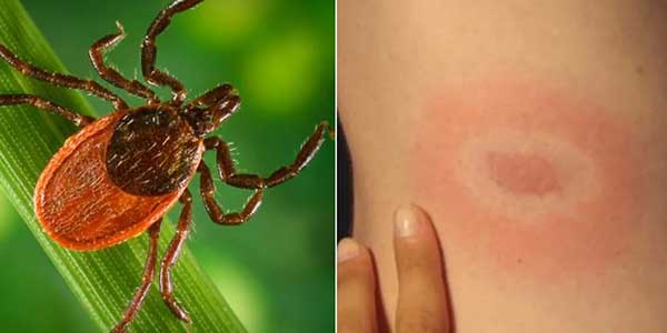 Child Safe Pest Control - Finding Solutions That Work